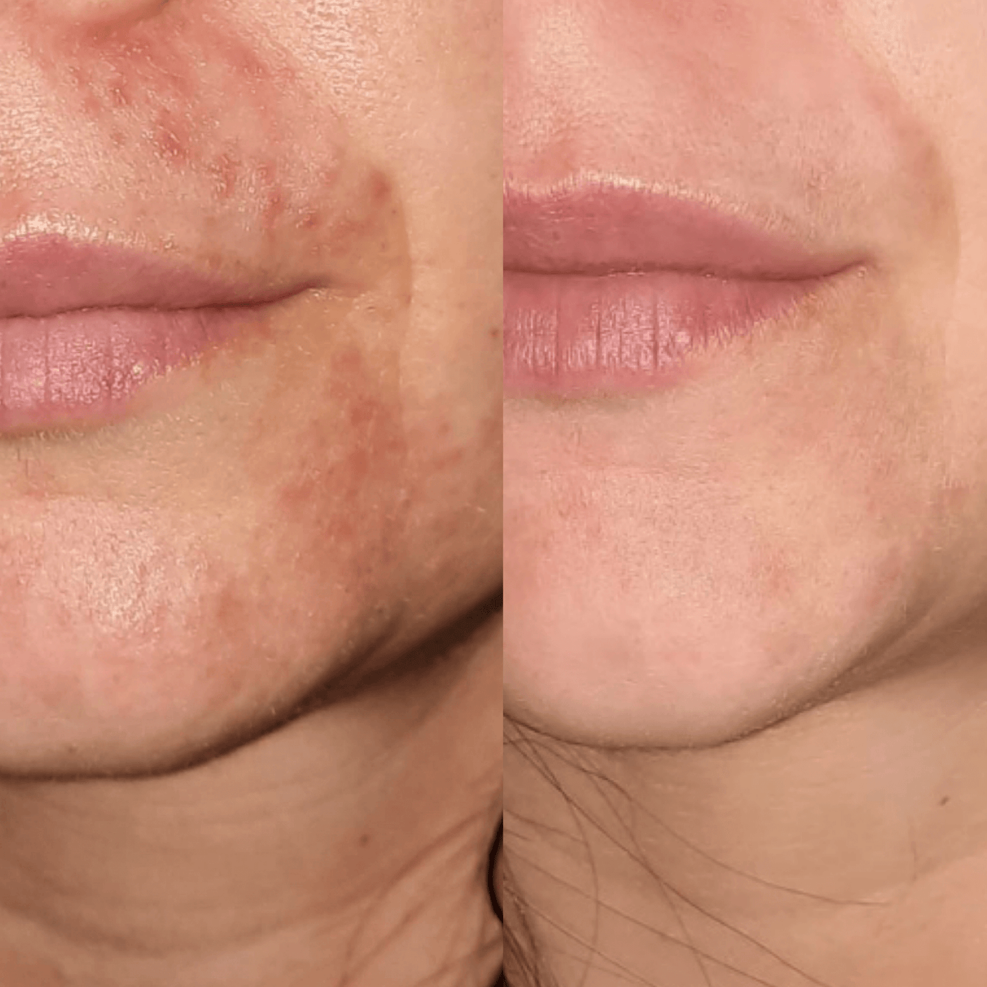 Calm Cream for Sensitive Skin – Allay Organics UK